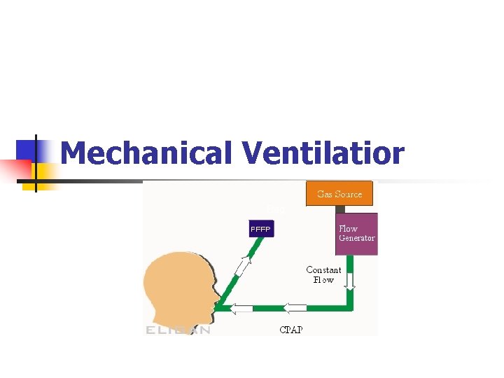 Mechanical Ventilatior Outline n n n n Definition