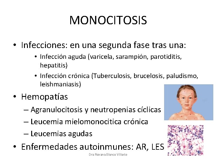 RECUENTO LEUCOCITARIO NEUTROFILOS EOSINFILOS BASOFILOS MONOCITOS ...