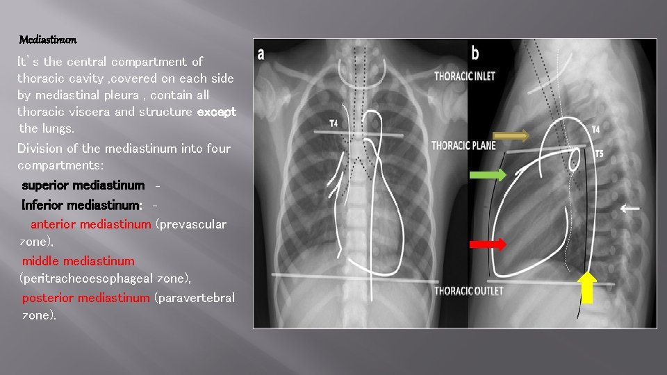 Mediastinum Its the central compartment of thoracic cavity