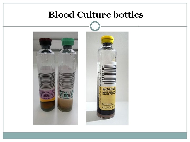 Microbiology of Bone and Joint Infections Osteomyelitis Septic