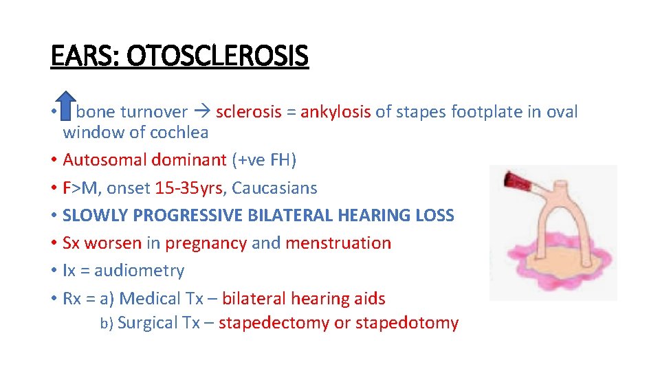 ENT Revision By Dr Emily Scanu Outline Ears