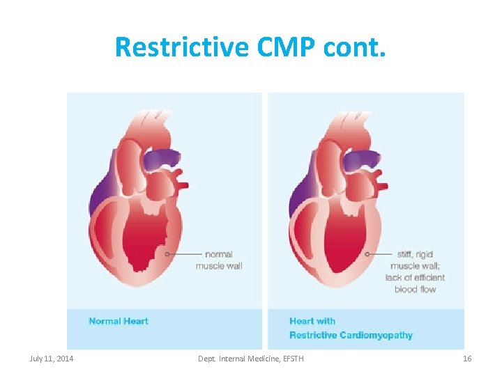 CARDIOMYOPATHY Dr K S Bojang Dept of Internal