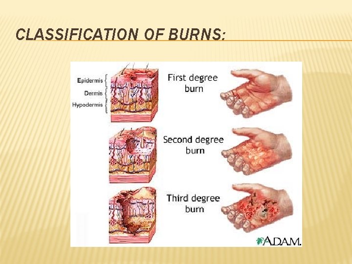 The Basics of What You Need to Know