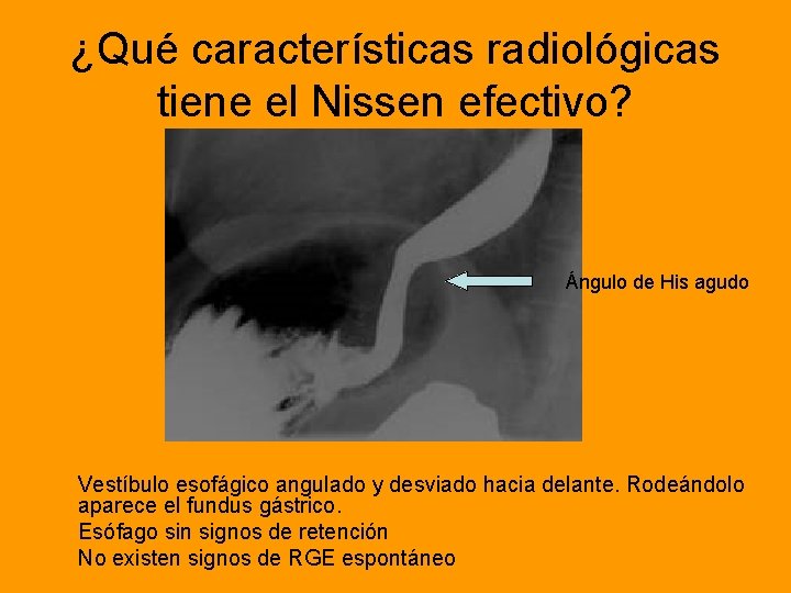 Estudio baritado esfagogastroduodenal del paciente postoperado Pablo Caro