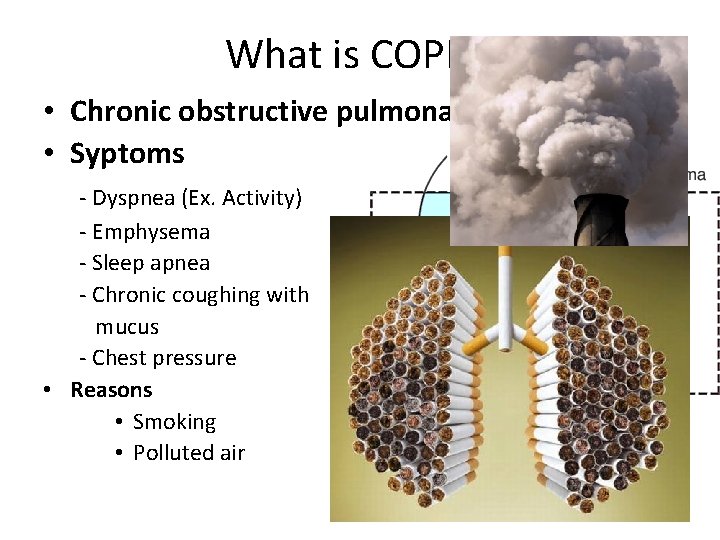 COPD Chronic obstructive pulmonary disease By Espen Gavin