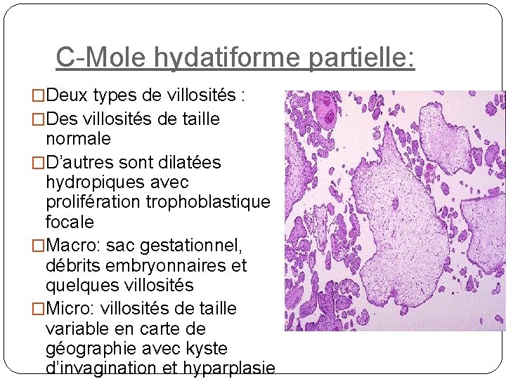 Pathologie placentaire Dr A Mahdjoub INTRODUCTION Le placenta