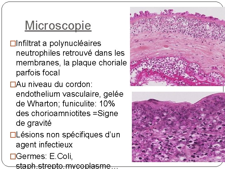 Pathologie placentaire Dr A Mahdjoub INTRODUCTION Le placenta