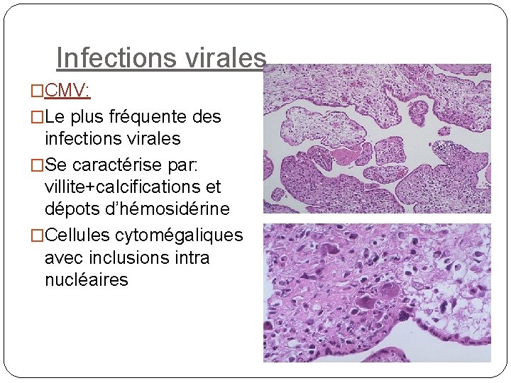 Pathologie placentaire Dr A Mahdjoub INTRODUCTION Le placenta