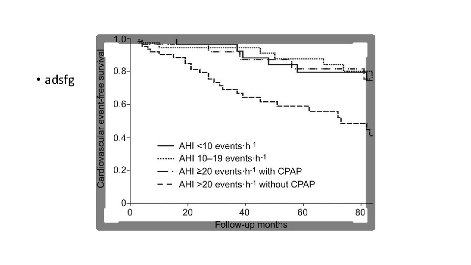 Surgical Management of Obstructive Sleep Apnea Caleb Wilson