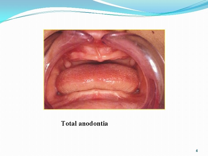 DEVELOPMENTAL DISTURBANCES OF TEETH 1 CONTENTS 1 Introduction
