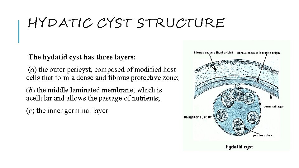 Presented By Hydatid Liver Cyst Dr Mohammad sadra