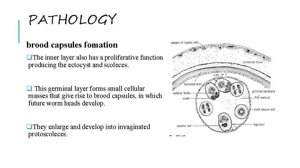 Presented By Hydatid Liver Cyst Dr Mohammad sadra