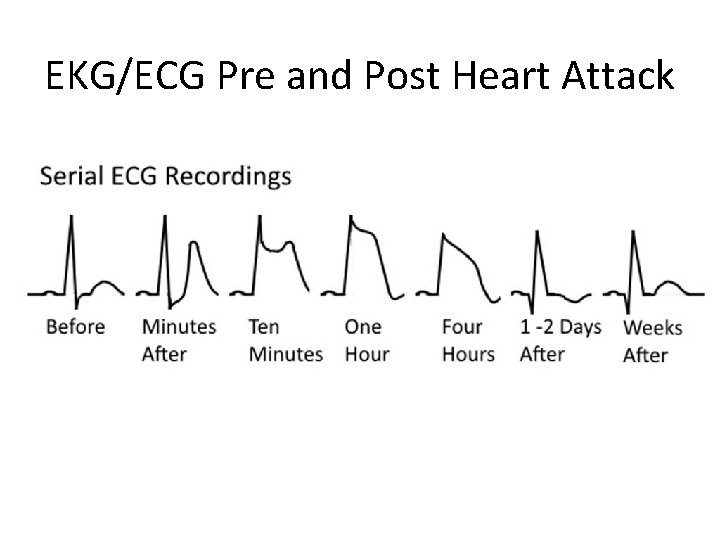 11 Interesting Facts About the Human Heart https