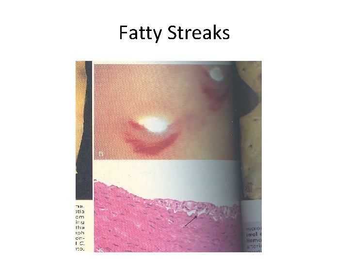 Chronic Inflammation Dr S Nishan Silva MBBS Chronic