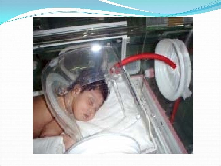 OXIGENOTERAPIA EN NEONATOLOGIA ADMINISTRACION DE OXIGENO q EL