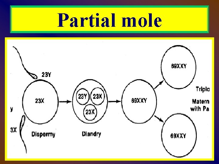 THE MANAGEMENT OF GESTATIONAL TROPHOBLASTIC NEOPLASIA Dr Ashraf
