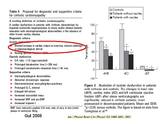Hepatorenal Syndrome What is it Akash Deep Director