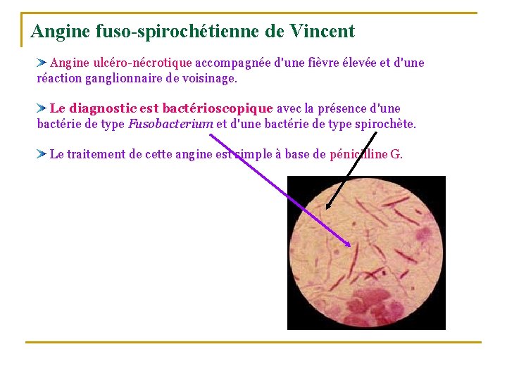 Les anarobies Aspect microscopique Bacilles Gram prsentant une