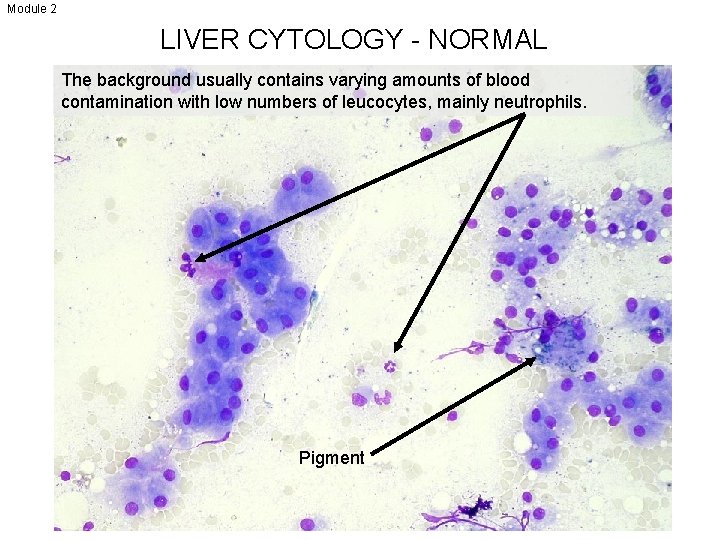 LIVER PATHOLOGY Revisionupdate notes on liver disease Prepared