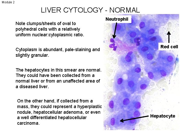 LIVER PATHOLOGY Revisionupdate notes on liver disease Prepared