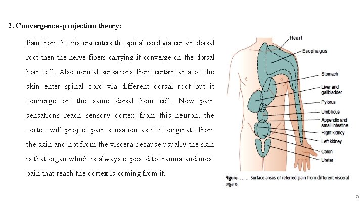 3 Visceral sensation and referred pain By Prof