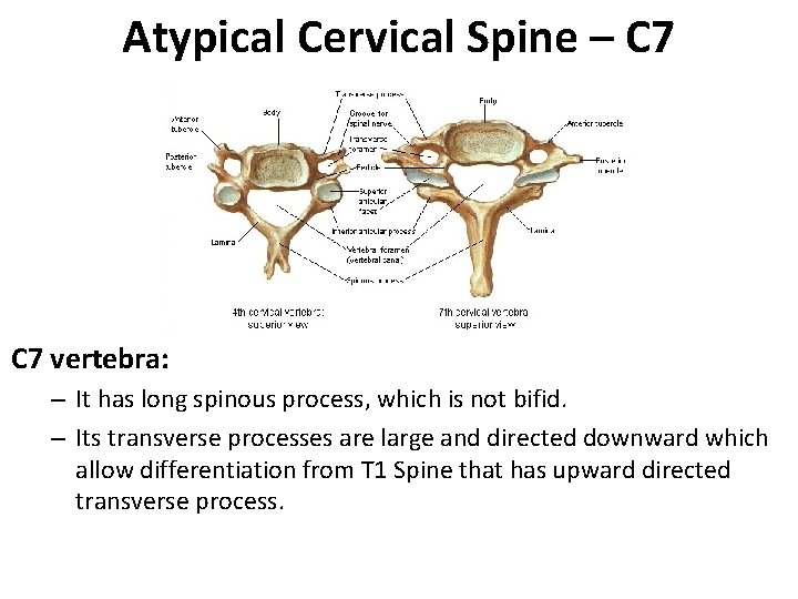 The Cranial Cavity Vault Sutures Coronal Sagittal Lambdoid