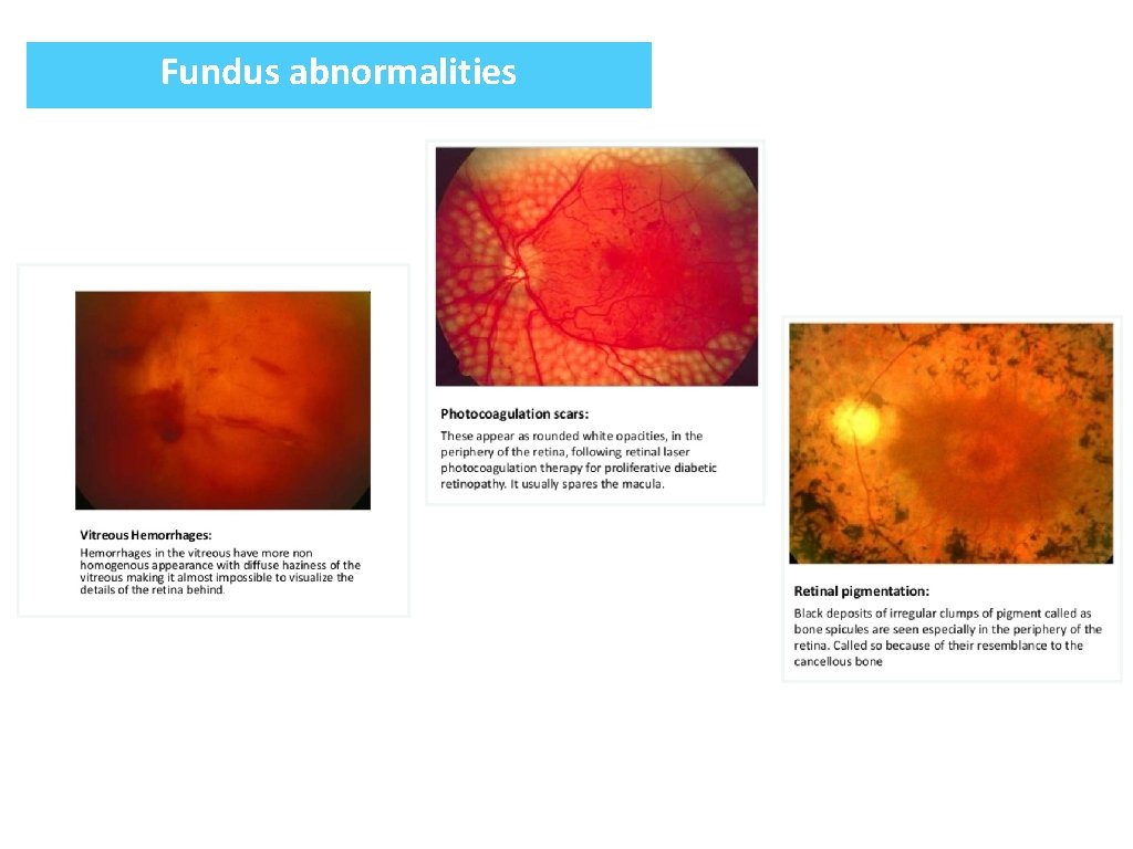 DIRECT OPHTHALMOSCOPE BY MOHAMMED SUHAIL ALSALAM LEARNING OBJECTIVES