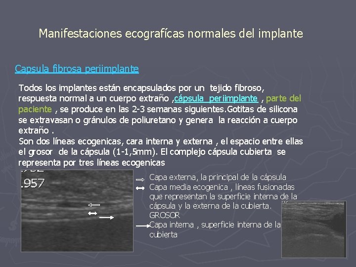 Nuestro objetivo es CONOCER Distintos tipos de implantes