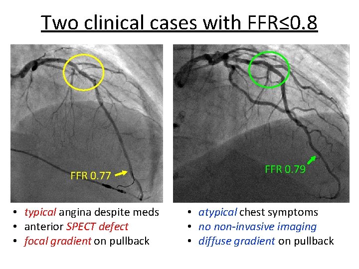 FFR as a continuum of risk What does