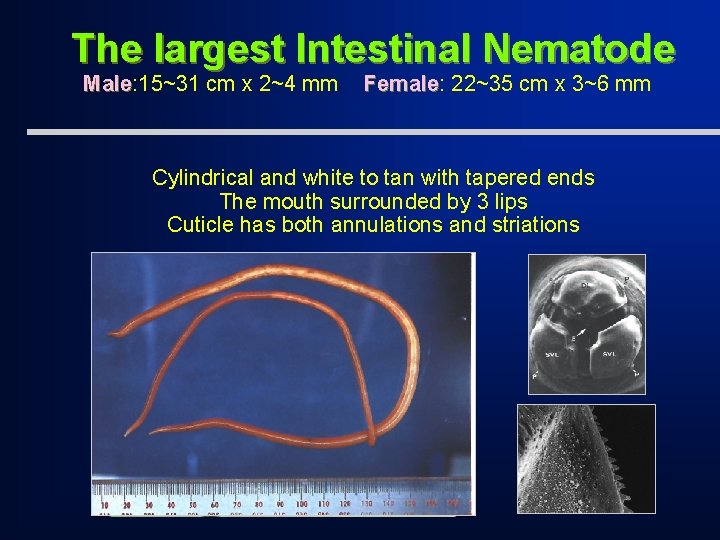Ascaris lumbricoides ASCARIASIS About 14 of the world