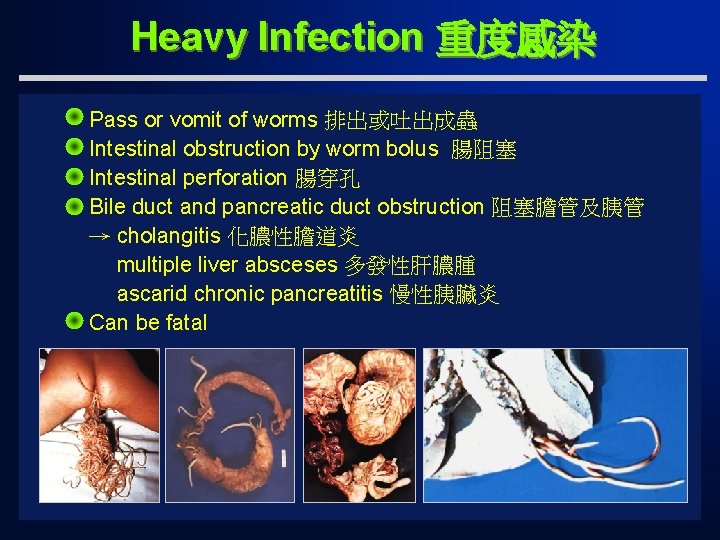 Ascaris lumbricoides ASCARIASIS About 14 of the world