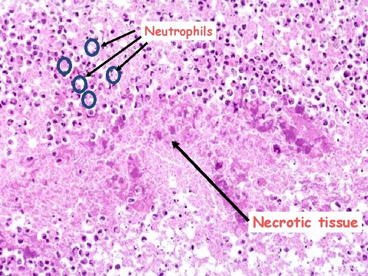 Cell injury By Dr Abdelaty Shawky Dr Gehan