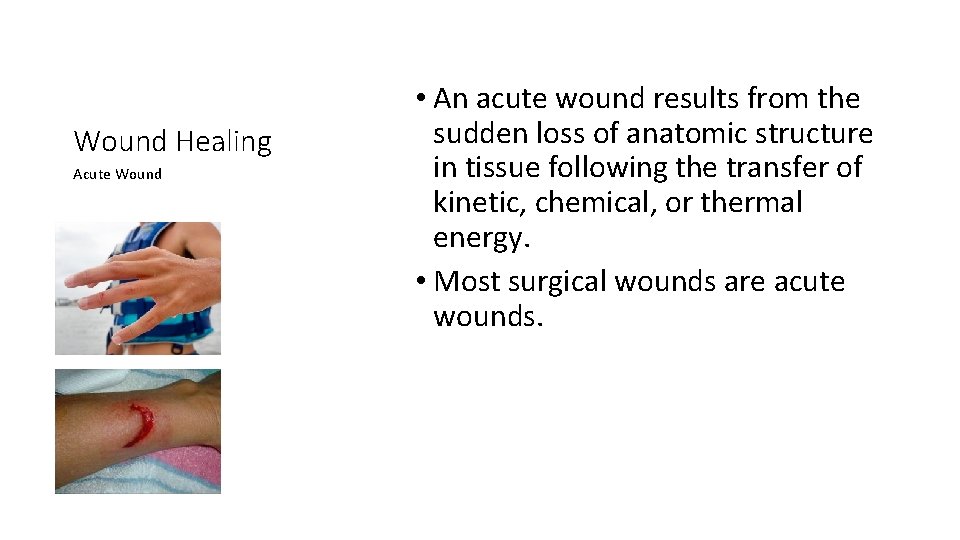 Wound Healing Wound Healing Acute Wound Chronic Wound