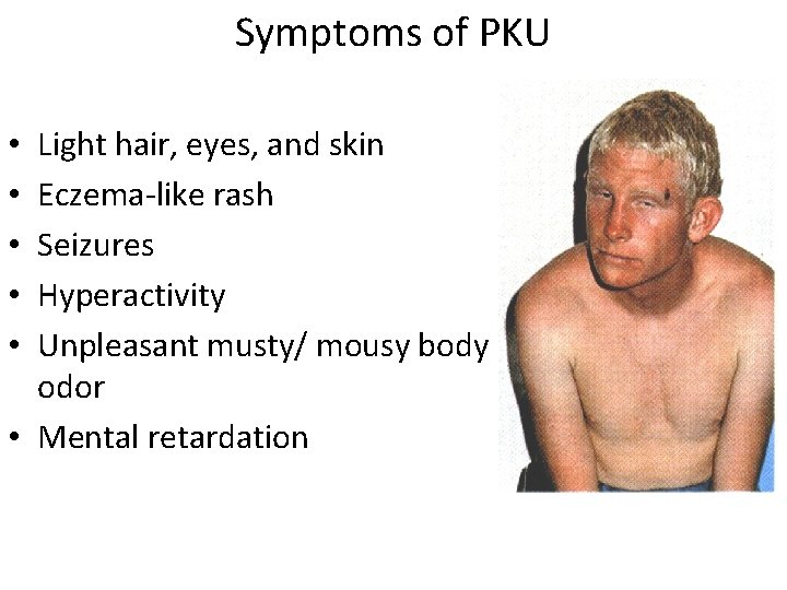 INBORN ERRORS OF AMINO ACIDS METABOLISM PHENYLALANINE METABOLISM