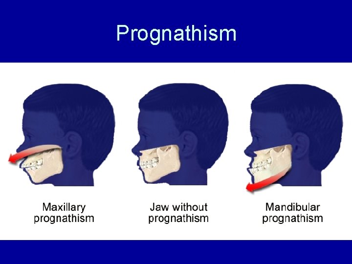 Composition and parts of the oral cavity palate