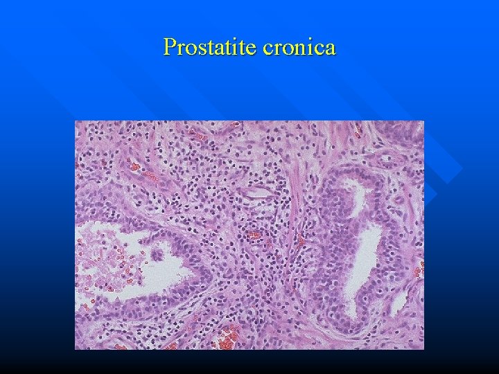 Patologia della prostata Anatomia della prostata n n