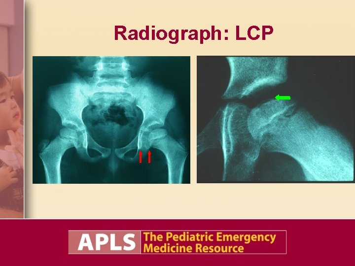 Nontraumatic Orthopedic Emergencies Objectives Understand the ...