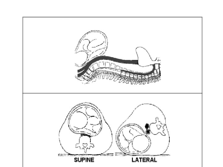 Maternal Cardiopulmonary Resuscitation Basic and Advanced Life Support