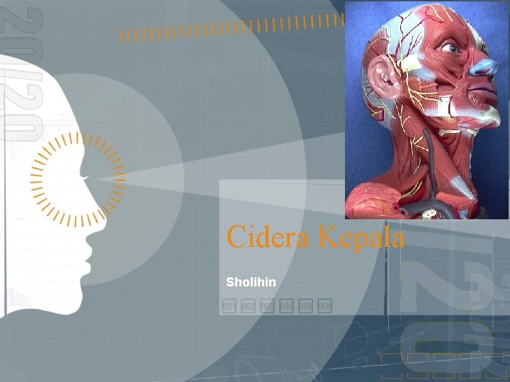 Cidera Kepala Sholihin CIDERA KEPALA 1 Pengertian Cedera