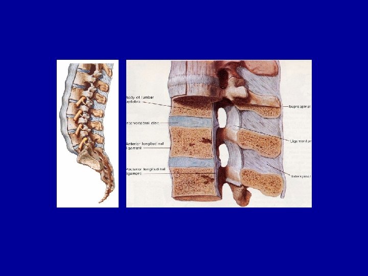 Lumbar Disc Herniation and Radiculopathy KS Hospital Spine