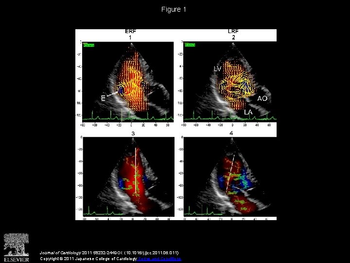 Physiological basis and clinical significance of left ventricular