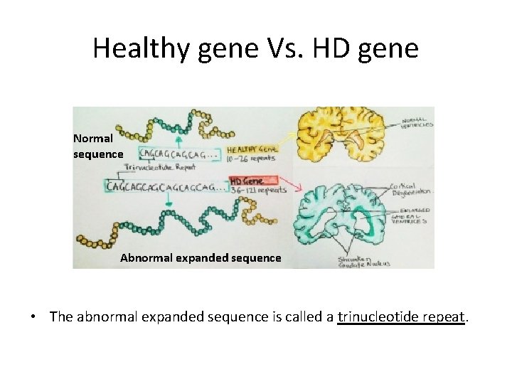 Huntingtons Disease By Catherine Peters What is Huntingtons