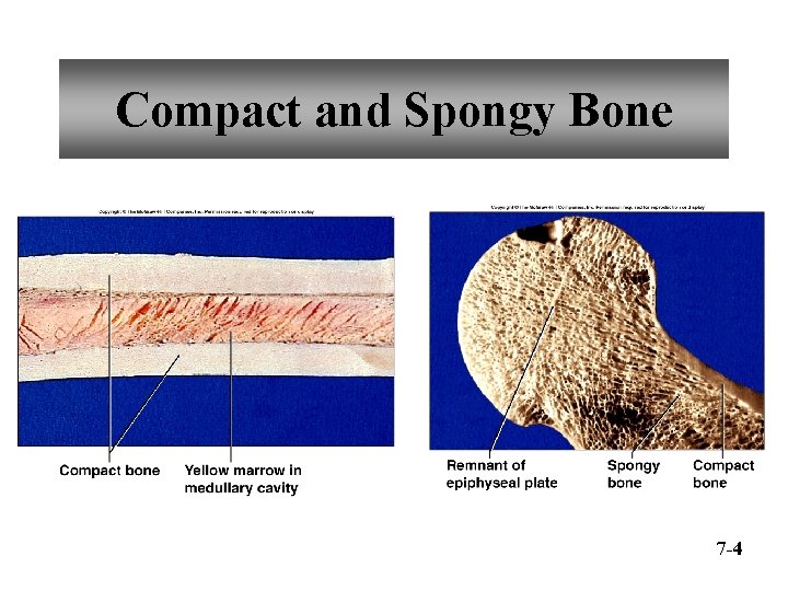 Chapter 7 Skeletal System Bone Classification Long Bones