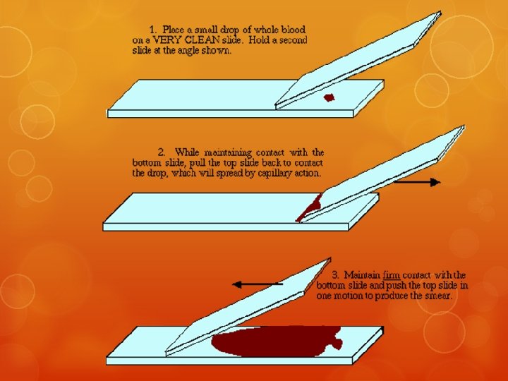 Packed Cell Volumes Total Proteins Blood Smear Prep