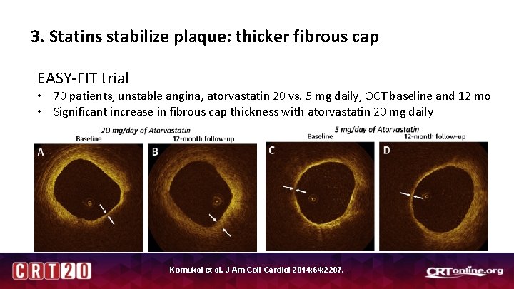 What do statins do to coronary atherosclerosis Rhanderson
