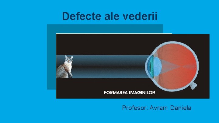 Defecte ale vederii Profesor Avram Daniela Vederea Ochiul