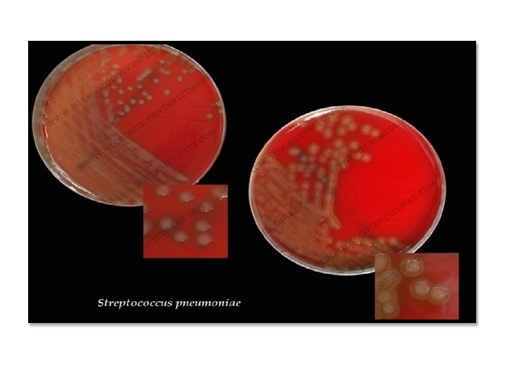 Culture media Pure culture techniques Bacterial colony Cultivation