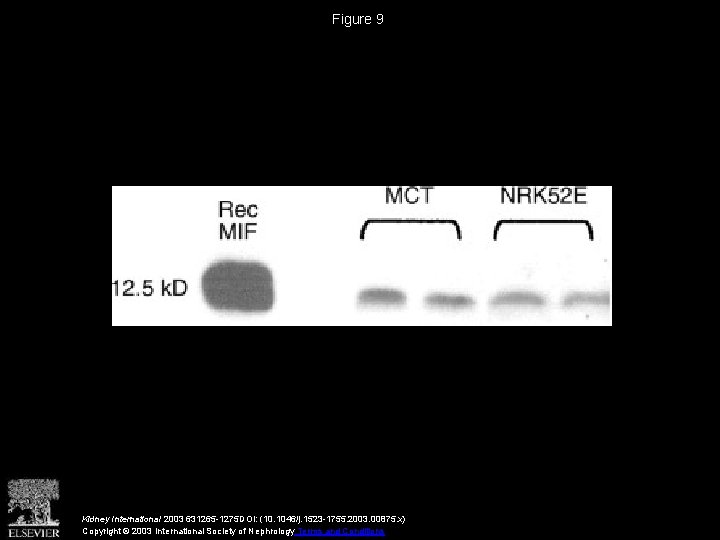 Induction of MIF synthesis and secretion by tubular