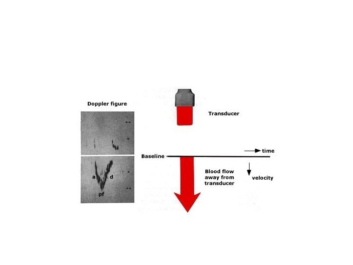 Doppler echocardiography tissue doppler Dolly mathew Properties of