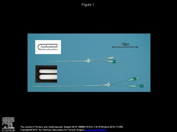 Combined use of an epidural cooling catheter and